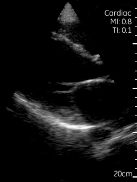 How to Obtain Focused Cardiac Ultrasound Images | The Scan