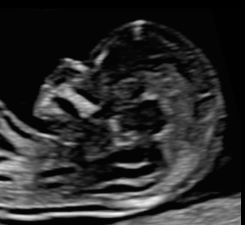 Optimizing Prenatal Imaging: The Role of Maternal-Fetal Medicine ...